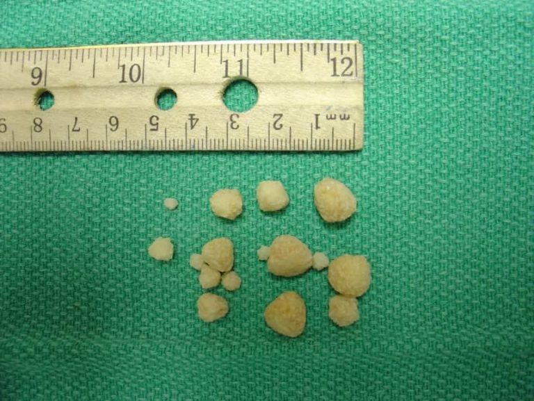 Rabbit Bladder Stones and Grit - Galens Garden