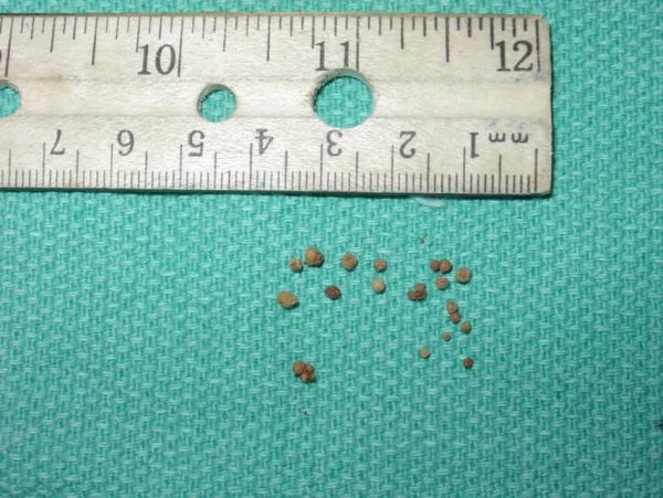 Rabbit Bladder Stones and Grit - Galens Garden